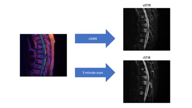 Klinische KI-Integration - Institut für Diagnostische und Interventionelle Radiologie und ...